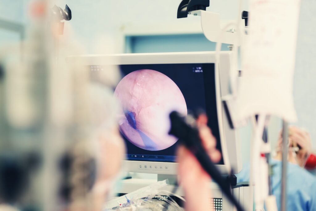 Endoscopia com biópsia: o que preciso saber antes de realizar o exame ...